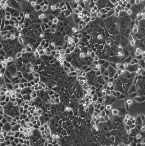 HCT-8细胞;人回盲肠癌细胞_人源_细胞系_现货细胞类_【官网】中国细胞系_原代细胞_病毒包装_质粒购买_载体构建_ORF基因_cDNA基因 ...