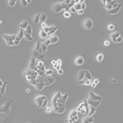 HONE-1细胞;人鼻咽癌细胞_人源_细胞系_现货细胞类_丰晖生物_【官网】细胞购买_稳转株_原代细胞_病毒包装_质粒购买_载体构建_ORF ...
