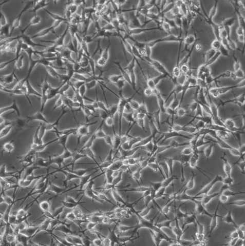 MC38细胞;小鼠结肠癌细胞_小鼠源_细胞系_现货细胞类_【官网】中国细胞系_稳转株_原代细胞_病毒包装_质粒购买_载体构建_ORF基因 ...