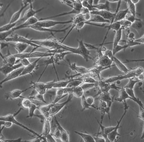 MC38细胞;小鼠结肠癌细胞_小鼠源_细胞系_现货细胞类_【官网】中国细胞系_稳转株_原代细胞_病毒包装_质粒购买_载体构建_ORF基因 ...