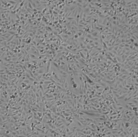 NCI-H1975细胞;人肺腺癌细胞_人源_细胞系_现货细胞类_【官网】中国细胞系_稳转株_原代细胞_病毒包装_质粒购买_载体构建_ORF基因 ...