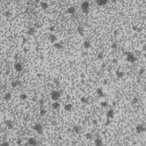 OCI-LY10细胞;弥漫大B细胞淋巴瘤细胞_人源_细胞系_现货细胞类_【官网】中国细胞系_原代细胞_病毒包装_质粒购买_载体构建_ORF基因_cDNA基因,中国细胞资源库保藏中心,丰晖生物 ...