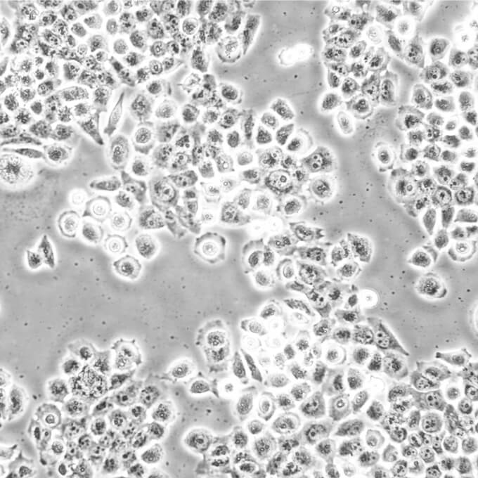 MKN45细胞;人胃癌细胞_人源_细胞系_现货细胞类_【官网】中国细胞系_原代细胞_病毒包装_质粒购买_载体构建_ORF基因_cDNA基因 ...