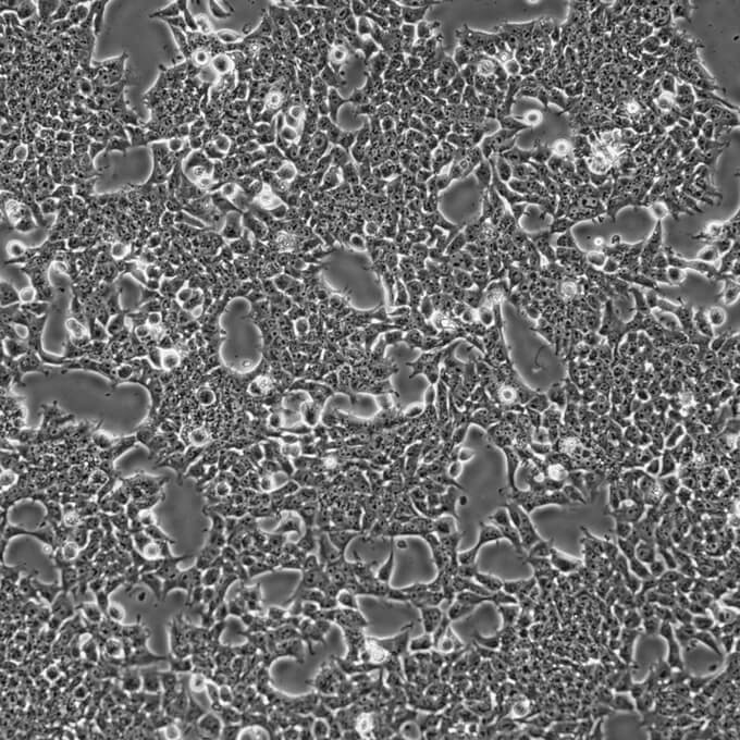 【热销】293A细胞;HEK293A;人胚肾细胞购买_人源_细胞系_现货细胞类_丰晖生物_【官网】细胞购买_稳转株_原代细胞_病毒包装_质粒 ...