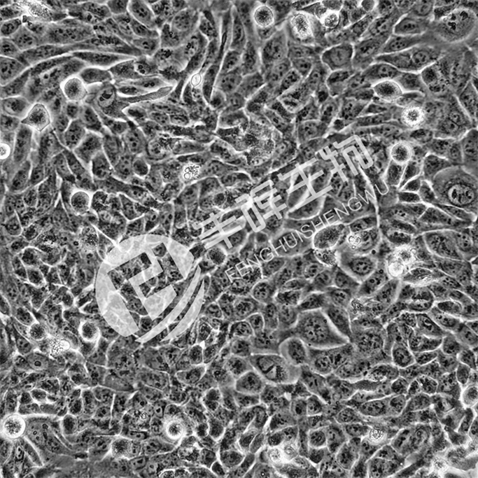 HCEC细胞;人角膜上皮细胞_人源_细胞系_现货细胞类_【官网】中国细胞系_原代细胞_病毒包装_质粒购买_载体构建_ORF基因_cDNA基因 ...