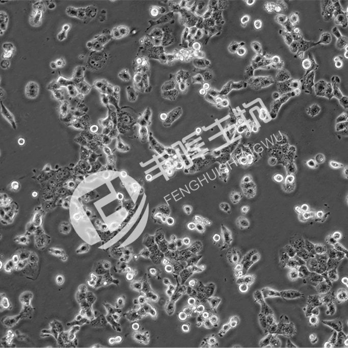 NCI-H1299细胞;人非小细胞肺癌细胞_人源_细胞系_现货细胞类_丰晖生物_【官网】细胞购买_稳转株_原代细胞_病毒包装_质粒购买_载体构建_ORF基因_cDNA基因,中国细胞资源库保藏 ...