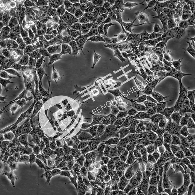 4T1-LUC细胞；小鼠乳腺癌细胞luc稳转株_现货稳转株_现货细胞类_丰晖生物_【官网】细胞购买_稳转株_原代细胞_病毒包装_质粒购买_载体 ...