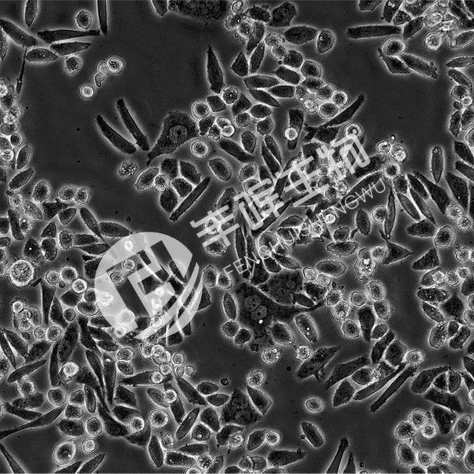 MDA-MB-453人乳腺癌细胞_人源_细胞系_现货细胞类_【官网】中国细胞系_原代细胞_病毒包装_质粒购买_载体构建_ORF基因_cDNA ...