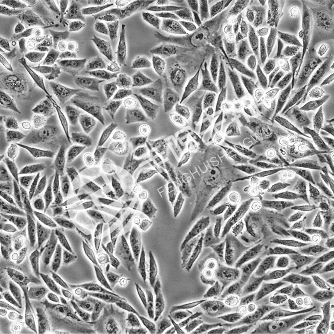 NP69细胞;人鼻炎上皮细胞_人源_细胞系_现货细胞类_丰晖生物_【官网】细胞购买_稳转株_原代细胞_病毒包装_质粒购买_载体构建_ORF基因 ...