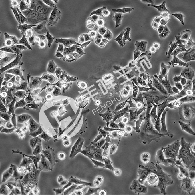 MB49细胞（小鼠膀胱癌细胞）