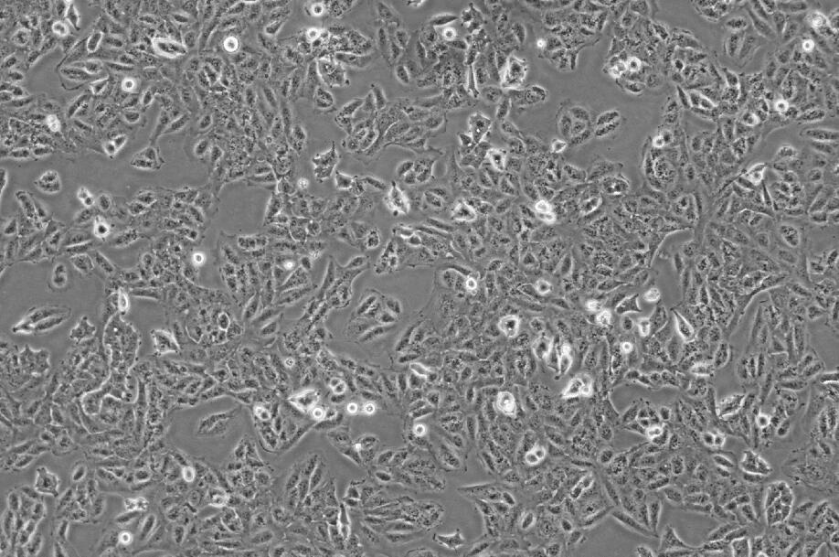 22RV1细胞;人前列腺癌细胞