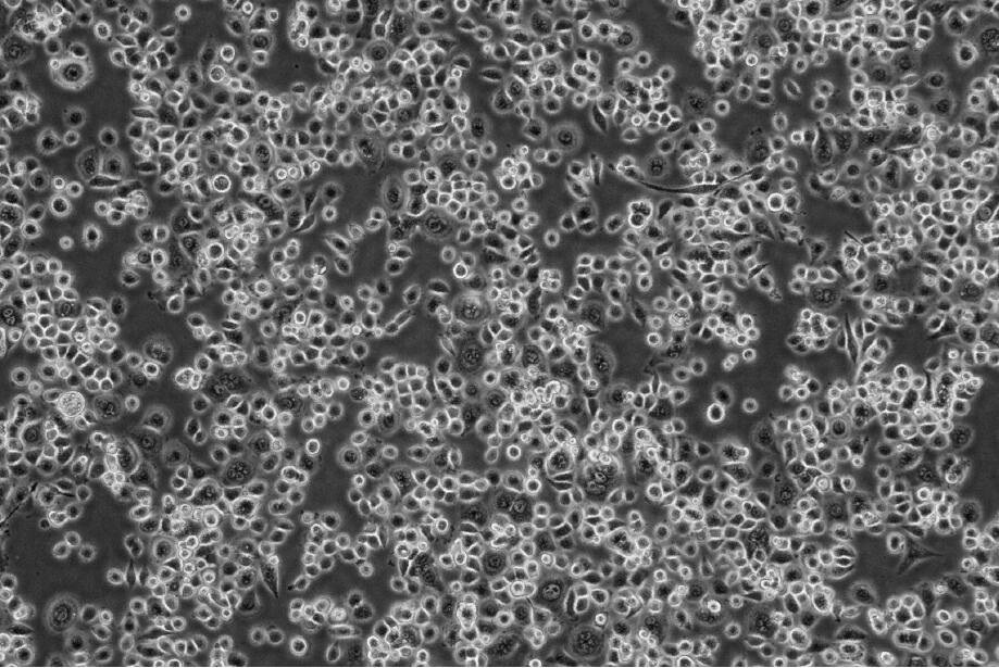 Aspc-1细胞（人胰腺癌细胞）