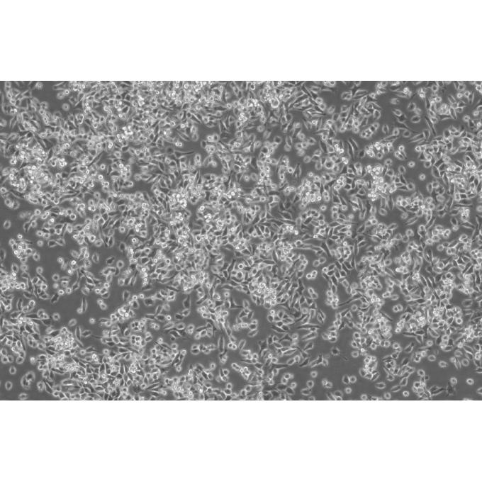 E0771细胞（小鼠髓样乳腺癌细胞）