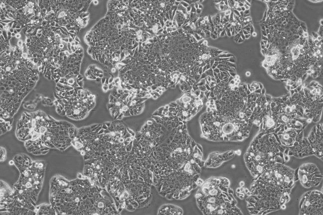 NCI-N87细胞（人胃癌细胞）