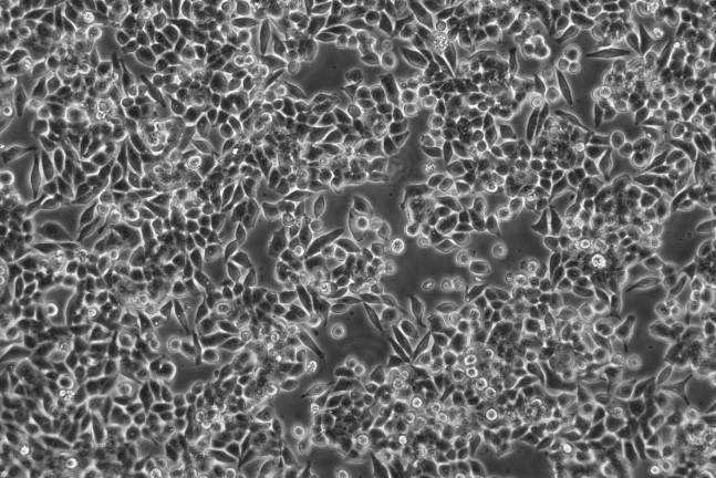 SW620细胞（人结肠癌细胞）