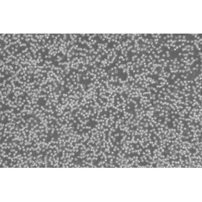 E0771细胞（小鼠髓样乳腺癌细胞）