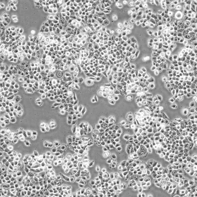 MKN45细胞（人胃癌细胞）