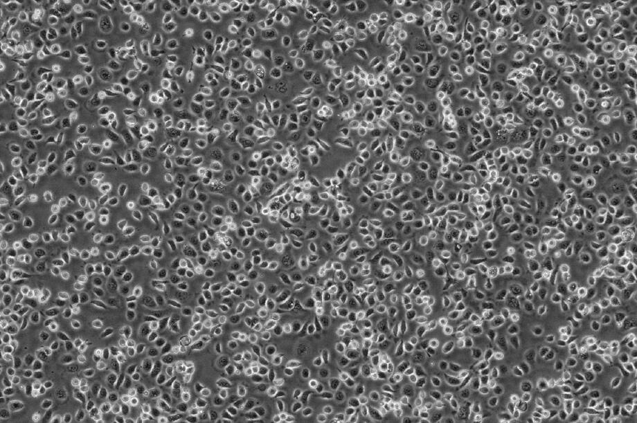 AGS细胞（人胃癌细胞）